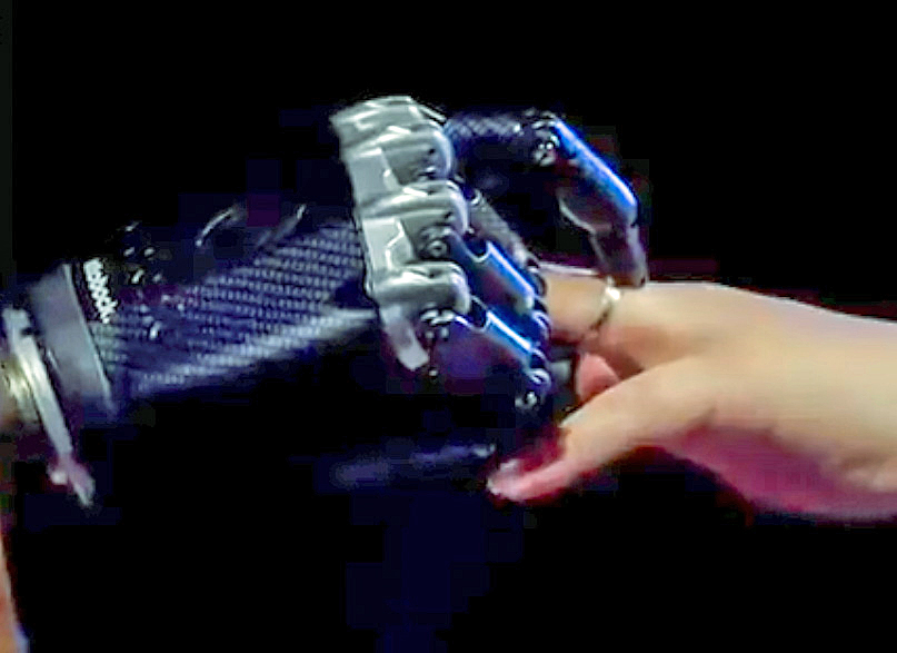 Watch Ukrainian Soldier Uses Prosthetic Hand To Slip Ring On Her Finger Positive Encouraging