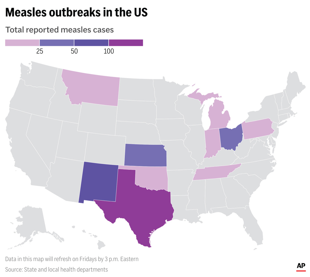 11th State Now Experiencing Outbreak Of Measles | Positive Encouraging ...